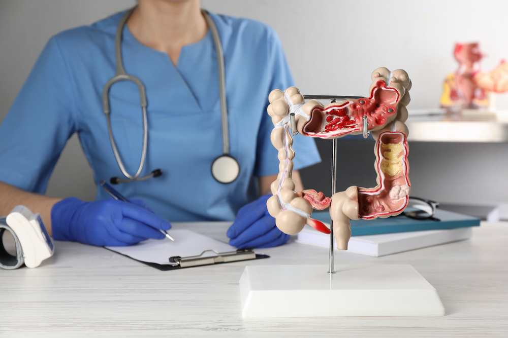 What To Expect After Colon Resection Surgery Hope Surgical What To Expect After Colon Resection Surgery Hope Surgical